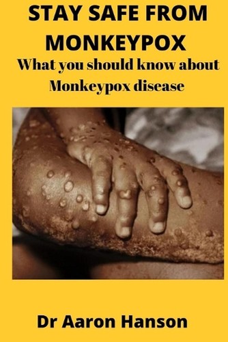 Stay Safe from Monkeypox: What You Should Know About Monkeypox Disease by Dr Aar 9798844026911| eBay