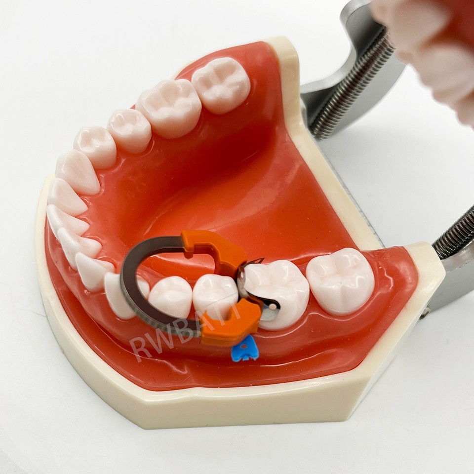 Dental Matrix Bands Ring Sectional Matrice Clamp Fit Garrison Palodent ...