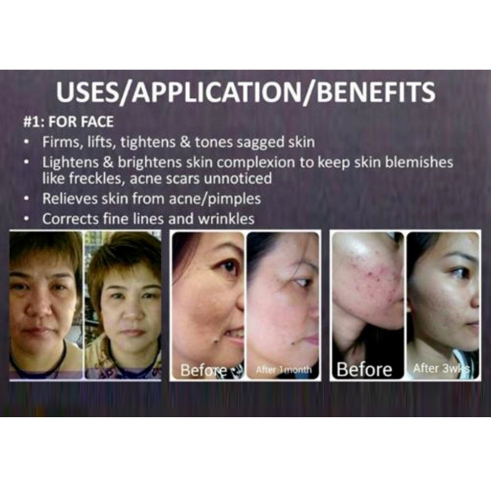 Firmax3 Firming & Lifting Cream Of Nanotechnology Hormone Therapy Anti ...