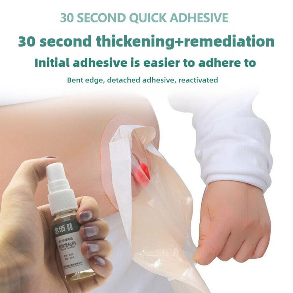 Stoma Glue Removal Stripping Colostomy Adhesive WipeOff Spray_ | eBay