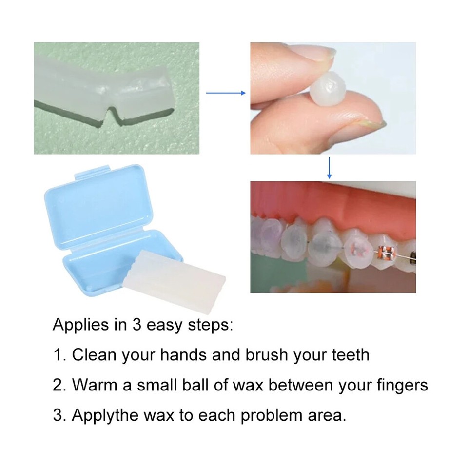10-1000 Box Dental Ortho Relief Wax fit Brackets Braces Gum Irritation ...