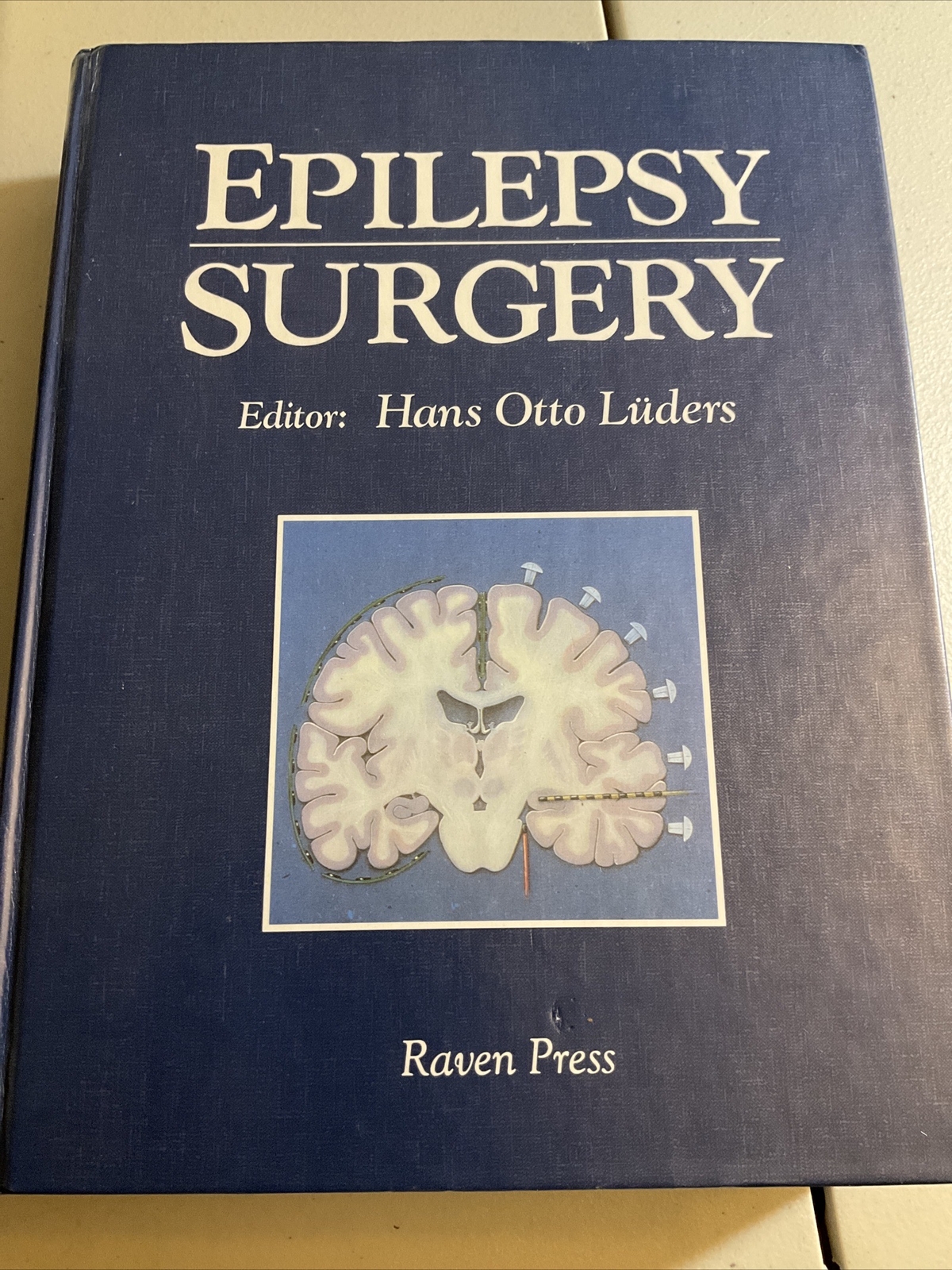 Epilepsy Surgery by Hans Otto Luders MD PhD. Raven Press 1992 | eBay