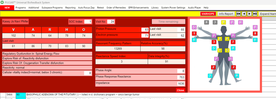 Used SCIO Quantum Biofeedback like Quest9, Qest4, EPX, Quex S | eBay