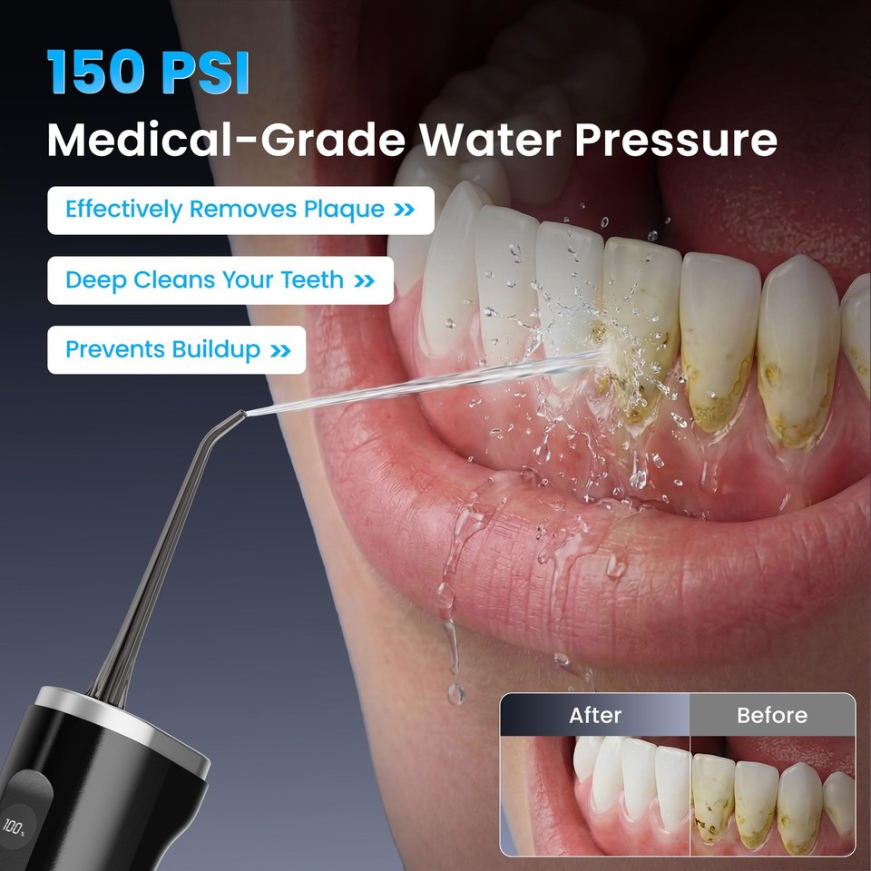 Water Flosser Teeth Picks, 100-Modes 150-Psi High Pressure Dental Floss ...
