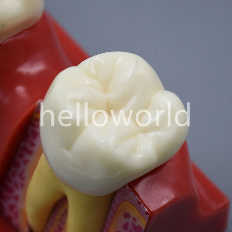 Dental Endodontic Study Teeth Model 4 Times Tooth Anatomy Anatomical ...