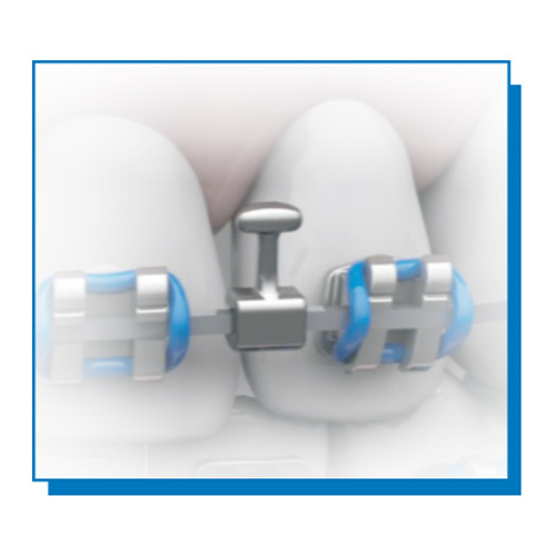 Crimpable split Hooks Orthodontic Straight Universal Ball Tip Bi ...