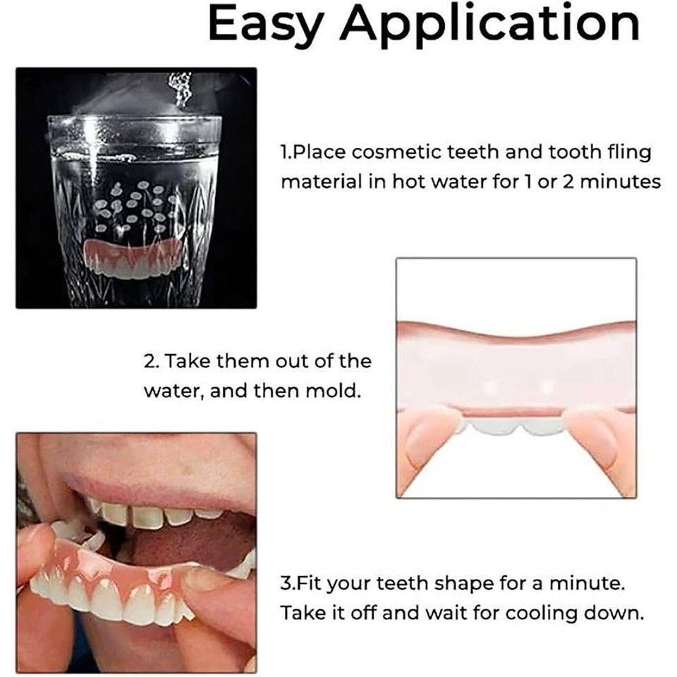 Easy Use Instant Teeth Silicone Reline Kit Soft Denture Silicone Reline ...
