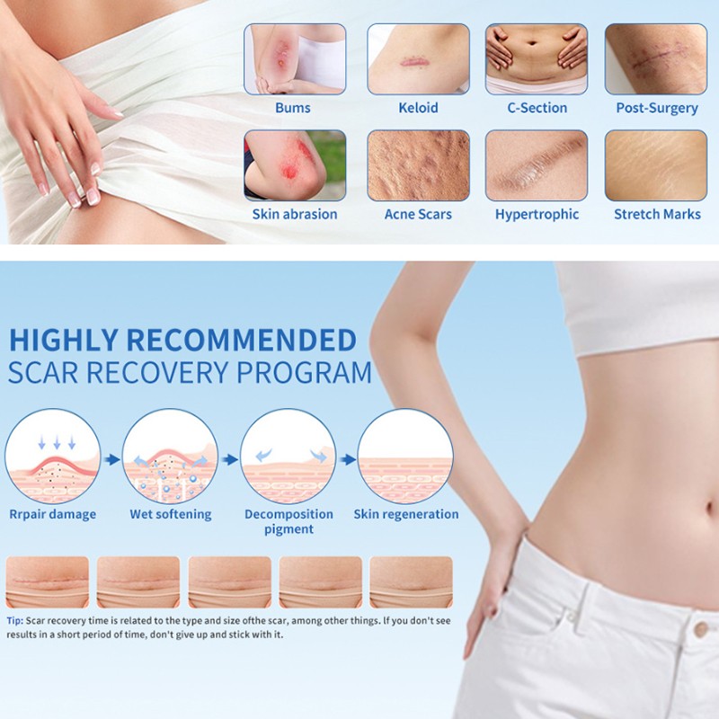 Scar Patches Remove Silicone 1mm Gel Treatment Patch Surgery Scar Tape ...