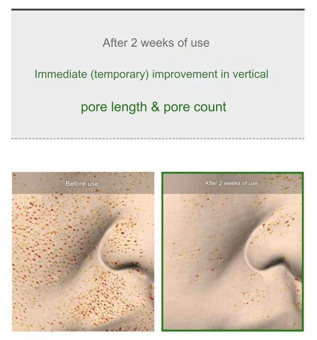 VT Cica Reedle Shot 100 50ml for Acne Blemish for Skin Texture K-Beauty ...