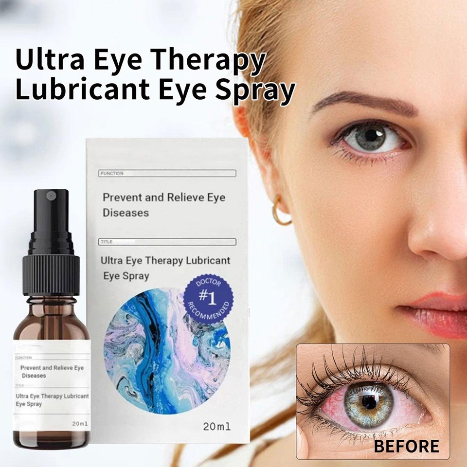 Eye Spray for Dry Eyes Natural Lubricating Eye Spray Dry Eye Relief ...