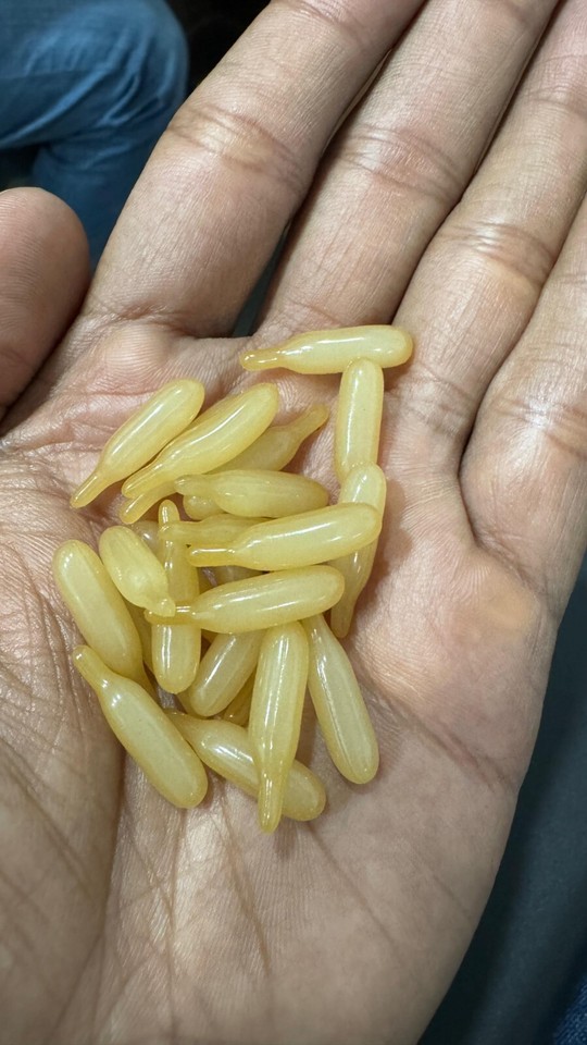 EYE Popta is used to treat bacterial Eye infections such as ...