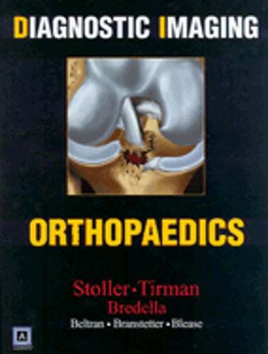 Diagnostic Imaging: Orthopaedics by Facr Stoller, David W, MD: Used ...