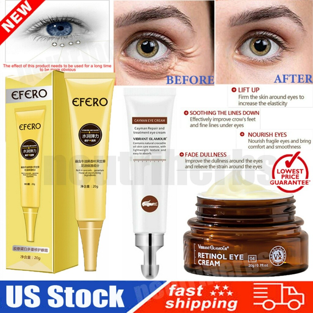 Best Under Eye Treatment