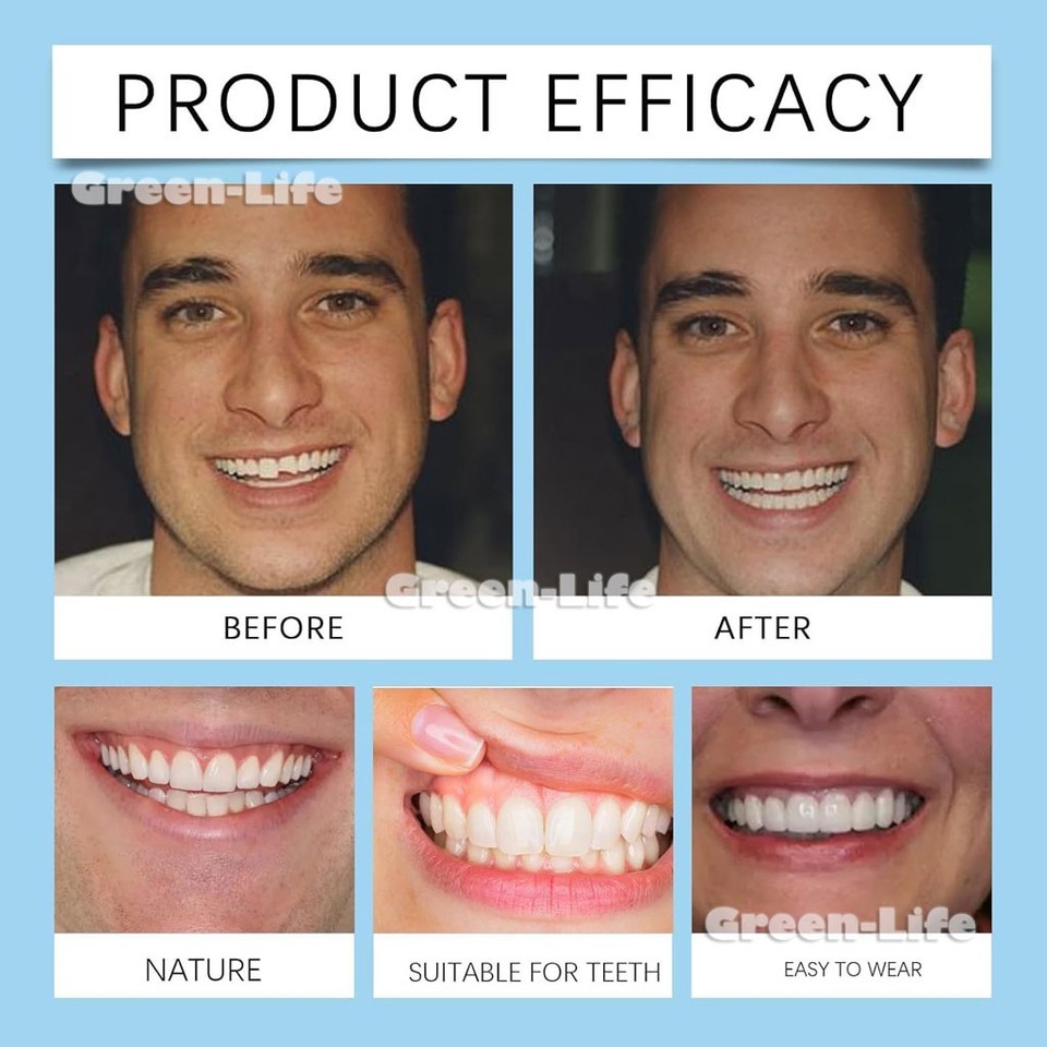 Silicone Reline Kit Denture Set Soft Silicone Denture False Teeth for ...