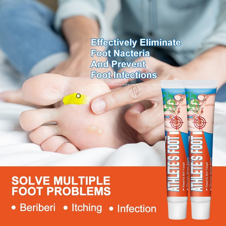 Beriberi Treat Athlete's Feet Ointment Foot Itching Anti-Fungal Peeling ...