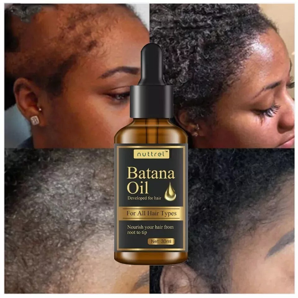 Pure Raw Botana Oil for Hair Growth From Honduras ( BUY 2 GET 1 FREE ...