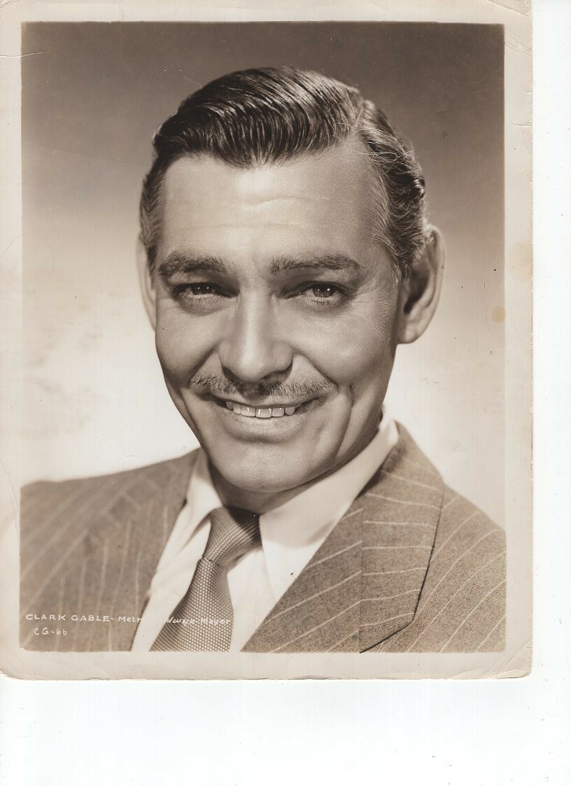Clark Gable Teeth