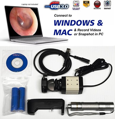 Rigid Stryker Endoscope Endoscopy ENT HD USB Portable Camera+LED Light ...