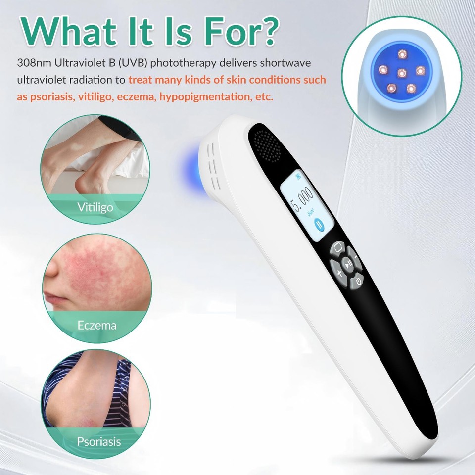 308nm UVB Blue Light Therapy Device 6 Diodes 20mW/cm² Handheld ...