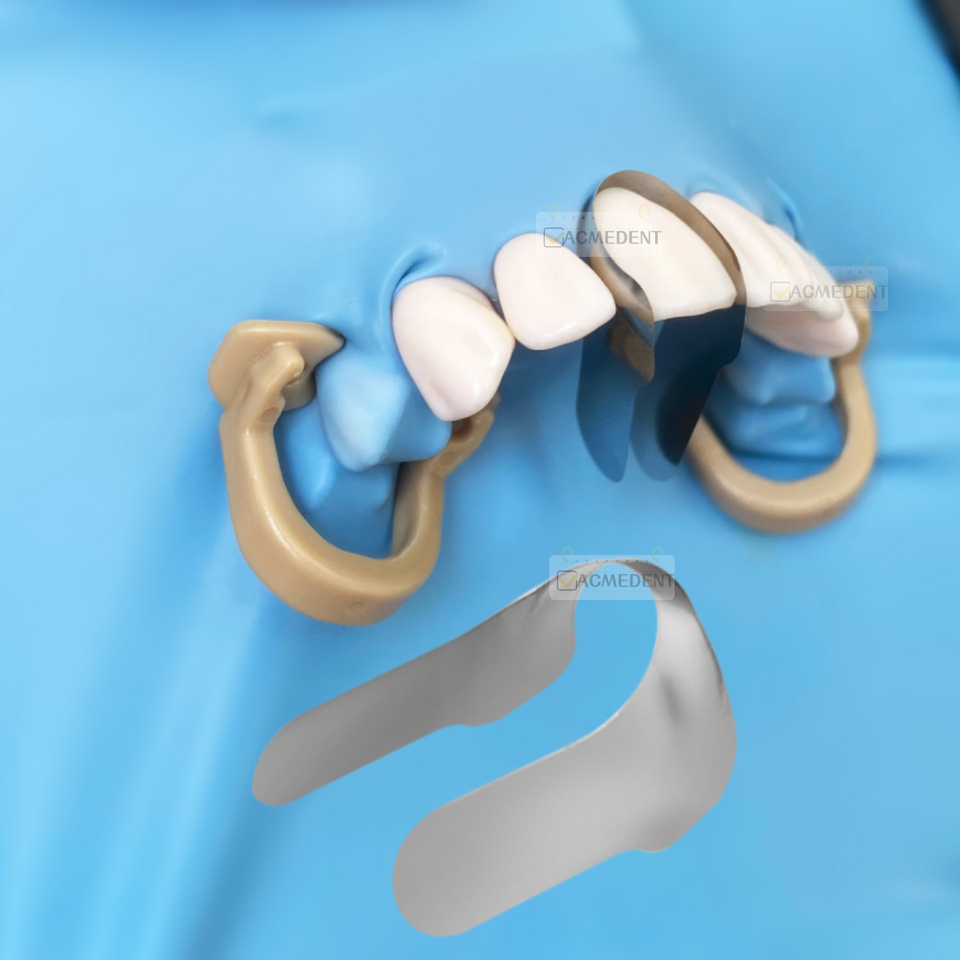 30/Box Dental Anterior Twin Matrices Cervical Matrix 1.523 Fits TOR VM ...