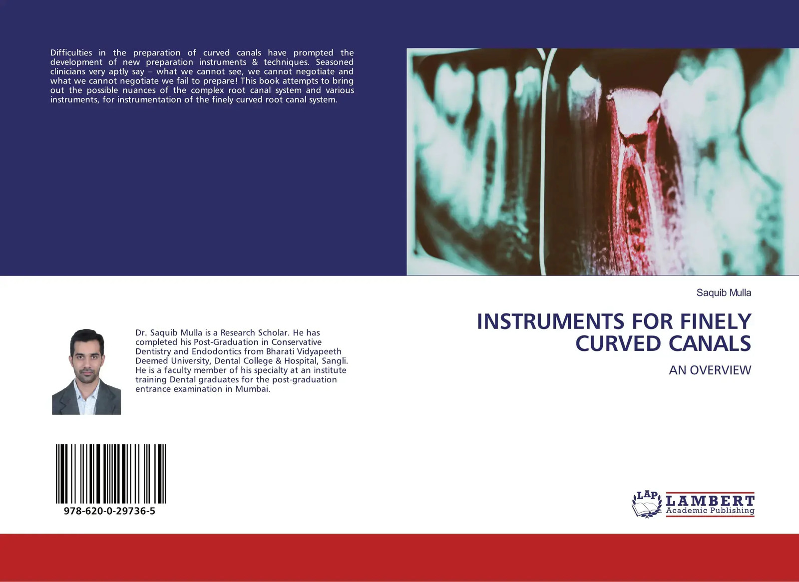 Saquib Mulla | INSTRUMENTS FOR FINELY CURVED CANALS | Taschenbuch ...
