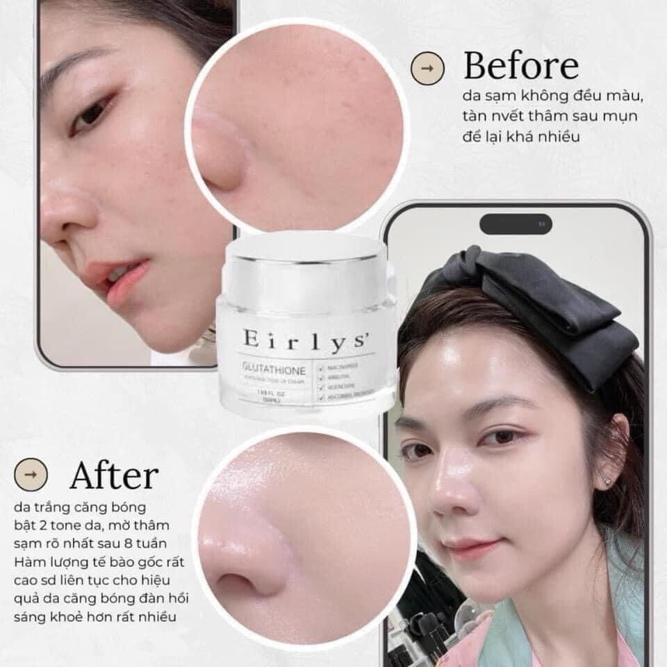 Eirlys' Glutathione Whitening Tone Up Cream 50ml Fade Dark Spots. Made In Korea | eBay