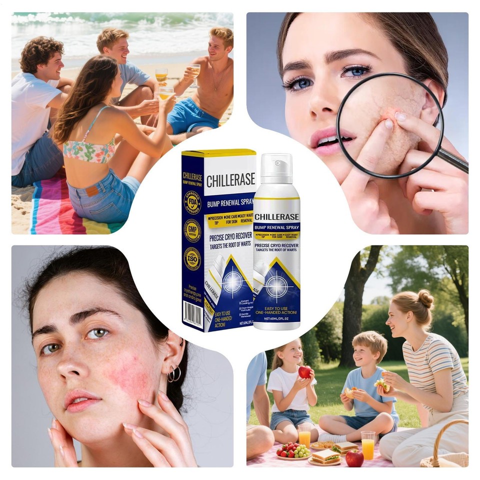 CHILLERASE Bump Renewal Spray 60ml Soothing Cooling Spray For Skin ...