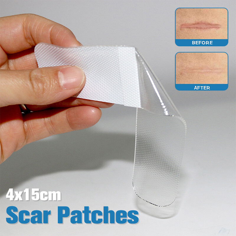 Silicone Scar Gel Away Strips Scar Remover Treatment Patch Reusable ...