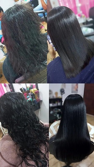 Cirugia Capilar | Escoba Brasilera Nutrycells 1LT | Células Madres ...