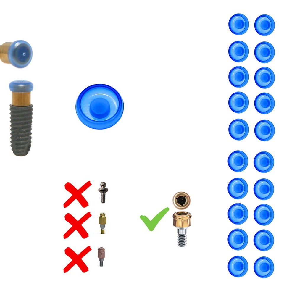 20Pcs US Replacement Male inserts Caps for Locator style abutments ...