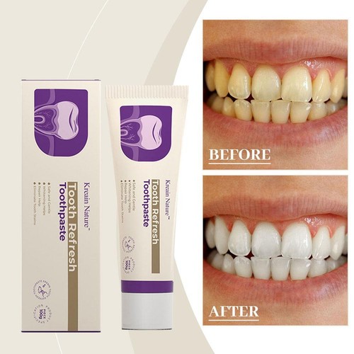 Nature Whitening Toothpaste 100g Niacinamide Intensive Whitening ...