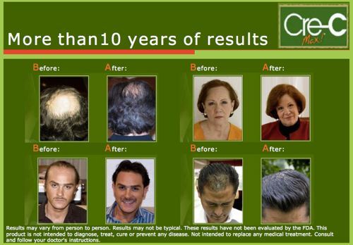 Shampoo Cre-C Max Hair Loss Cre C Shampo 250 ml Herbal Control | eBay