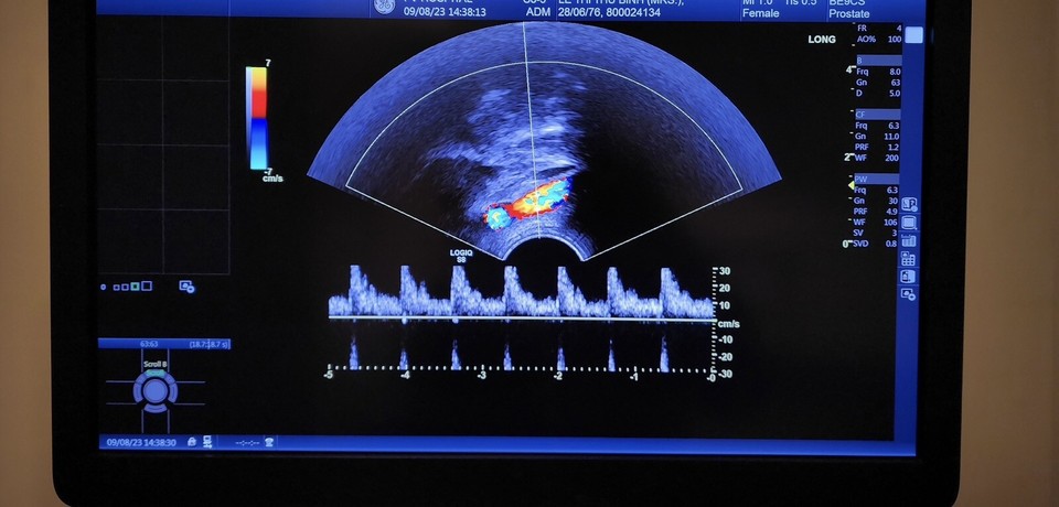 Ge ultrasound probe BE9CS-D | eBay