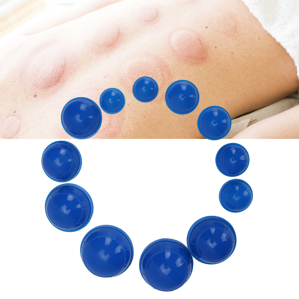Silicone Cupping Device Blue Massaging Acupuncture Cupping CupalthCare ...