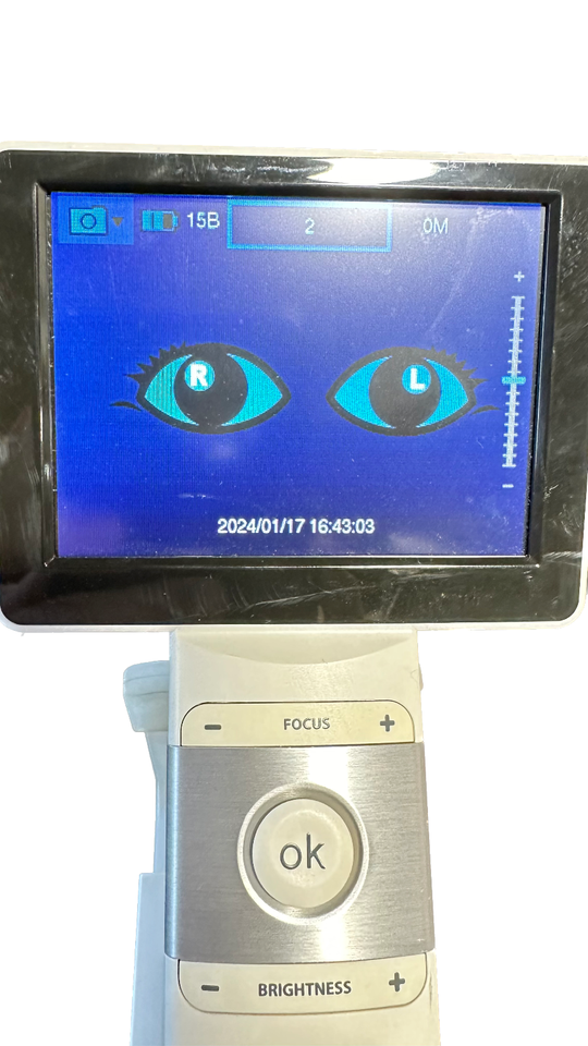 MiiS HORUS SCOPE DEC 200 5mp EYE care - USED | eBay