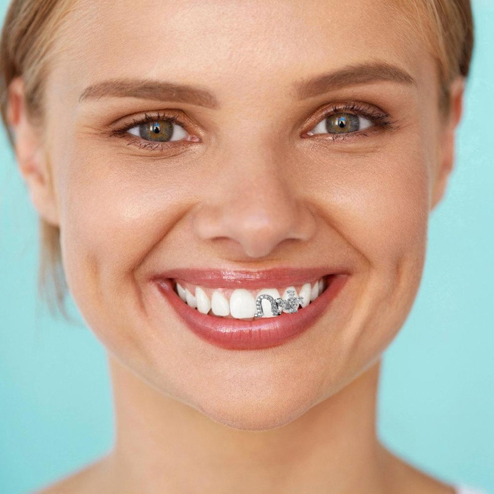 Grills Teeth Men: Hip Hop Teeth Grill For Rappers - Tooth Jewelry For ...