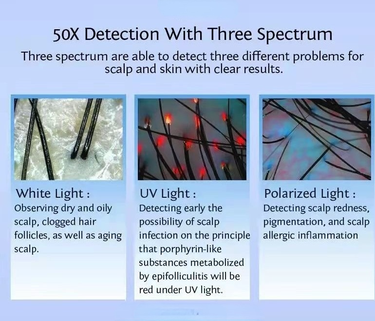 11'' Professional Hair Follicles Scalp Camera Digital Skin Microscope ...