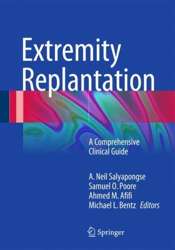 Extremity Replantation : A Comprehensive Clinical Guide by Samuel Poore ...