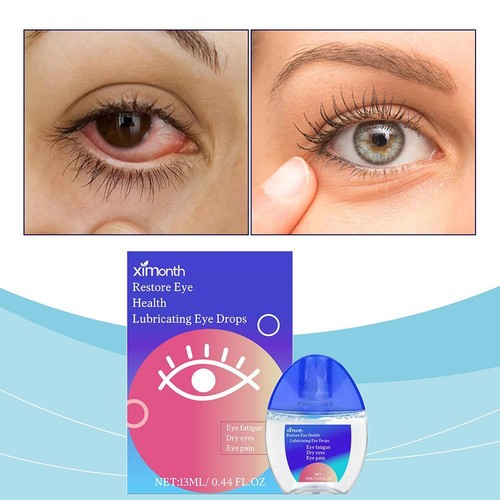 Safe& Soothing Eye Drops for Tired Red Eyes - Provides Moisture and ...