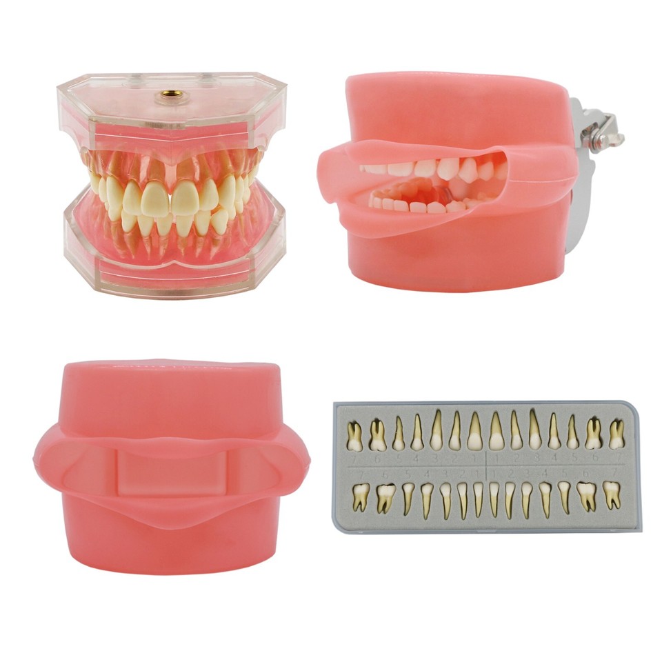 Dental Typodont Teeth Model Ortho Implant Pathological Perio Practice ...