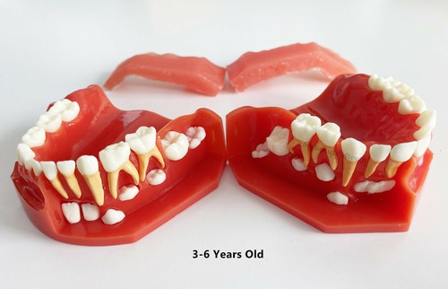 Dental Pediatrics Teeth Model Children Primary Permanent Alternate 3-6 ...