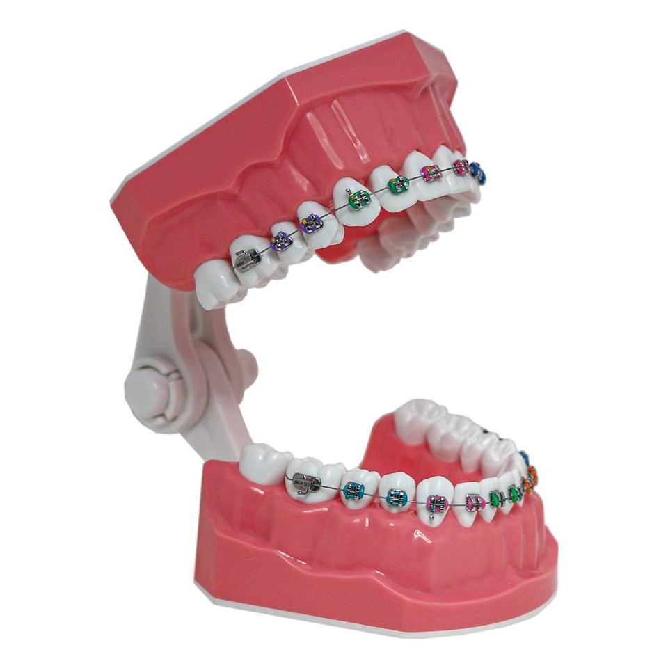 Newly upgrade Dental Ortho Typodont Demo Study Teeth Model with ...