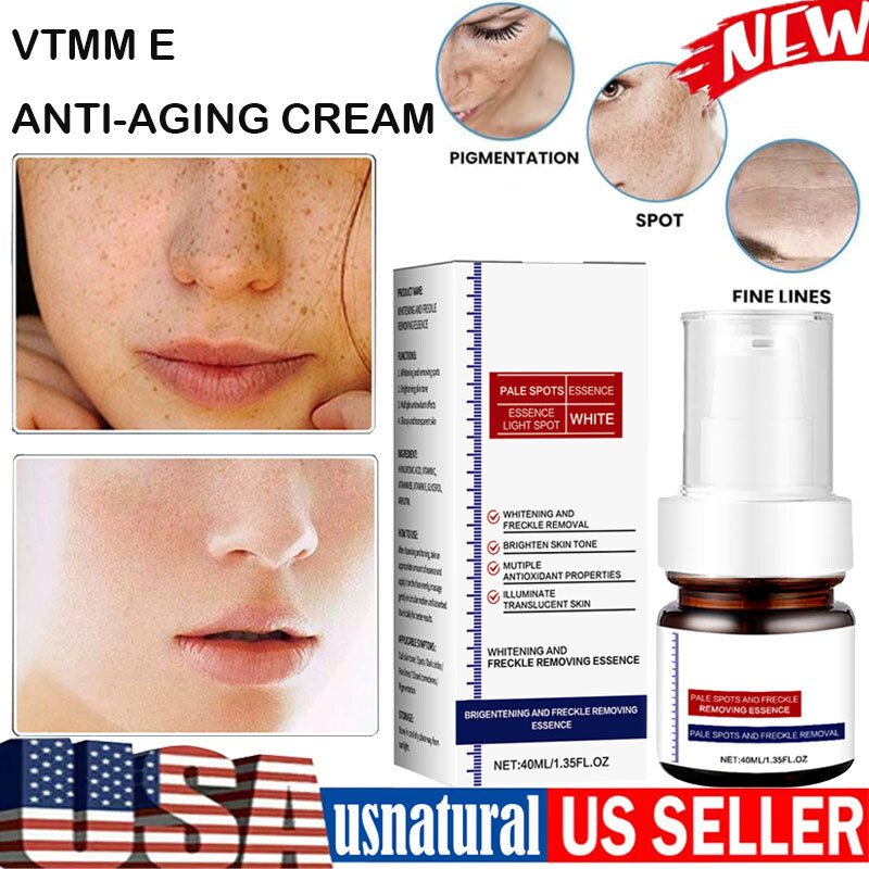 Effective Whitening Freckle Cream Remove Dark Spot Cream Removal ...