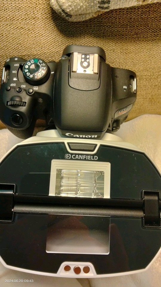 Canfield VECTRA H2 FACIAL SCANNER AND BODY CAMERA - PERFECT CONDITION ...