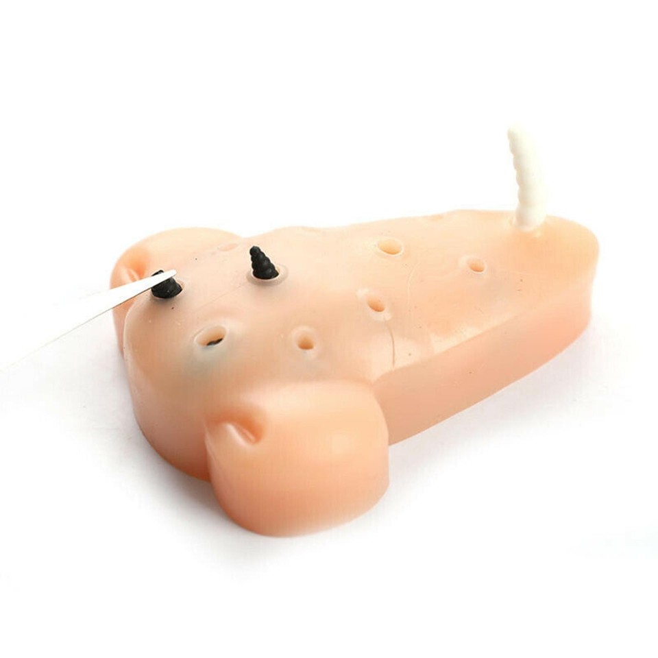 Soft Blackhead Shape Pimple Toys Squeeze Acne Stress Relief Popper ...