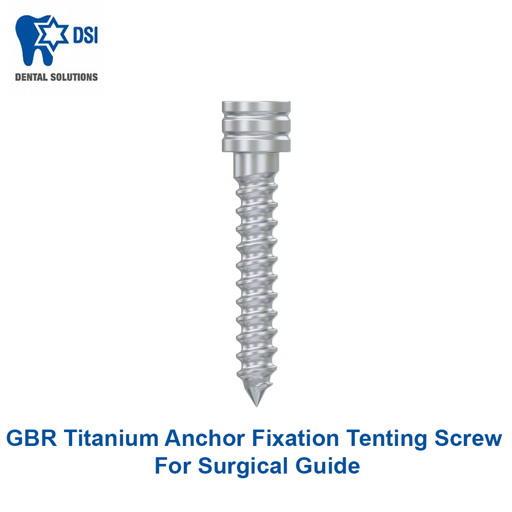 Dental DSI GBR Titanium Anchor Fixation Tenting Screw For Surgical ...