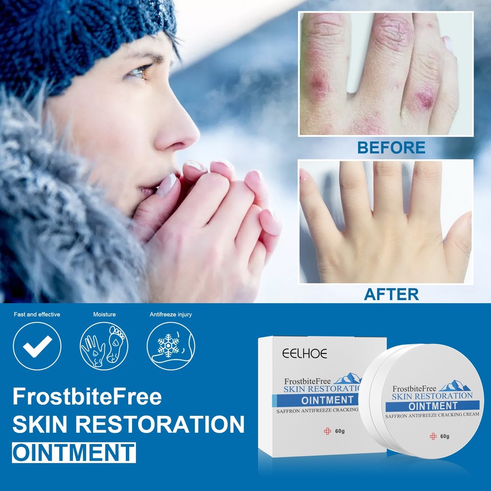 OEM Frost Protection Cream 60g Lanolin Hyaluronic Acid Petrolatum ...