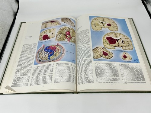 Netter CIBA Collection of Medical Illustrations Nervous System Vintage ...