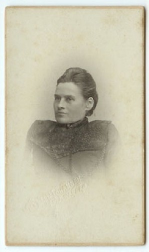 FREAK STRANGE ODD RARE CDV: Woman with No Neck Medical Anomaly Carte de ...