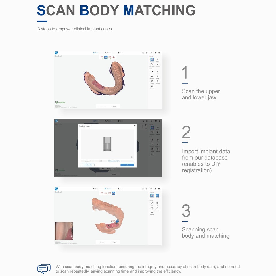 Dental Intraoral Scanner Digital Impression Intra Oral 3D True Color Scanner Lab | eBay